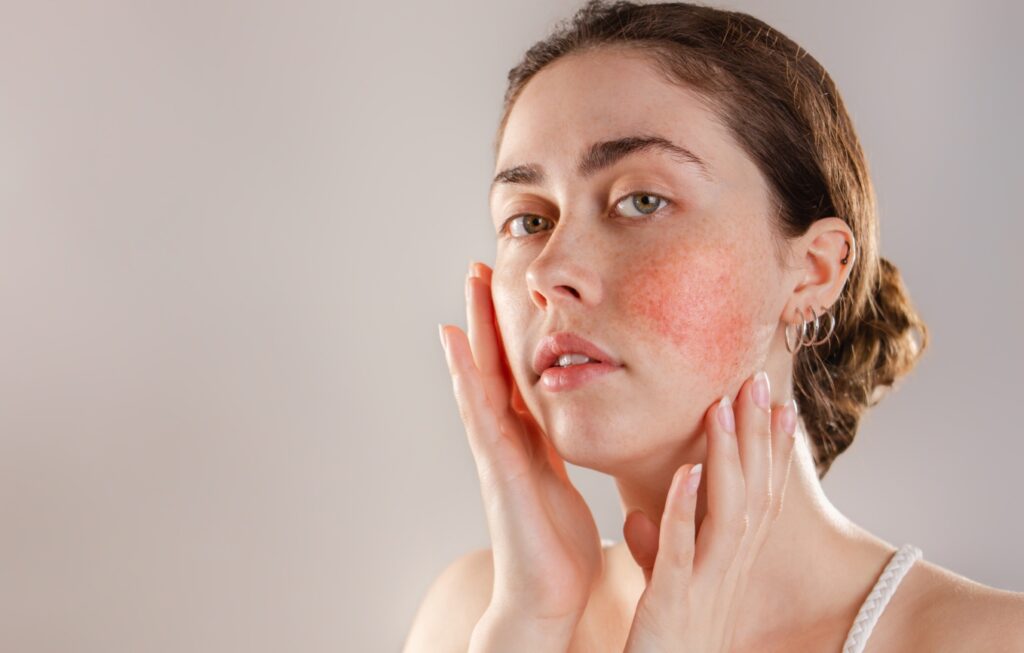 Laser couperose à Dijon | Soins esthétiques | Centre Médical Laseraser